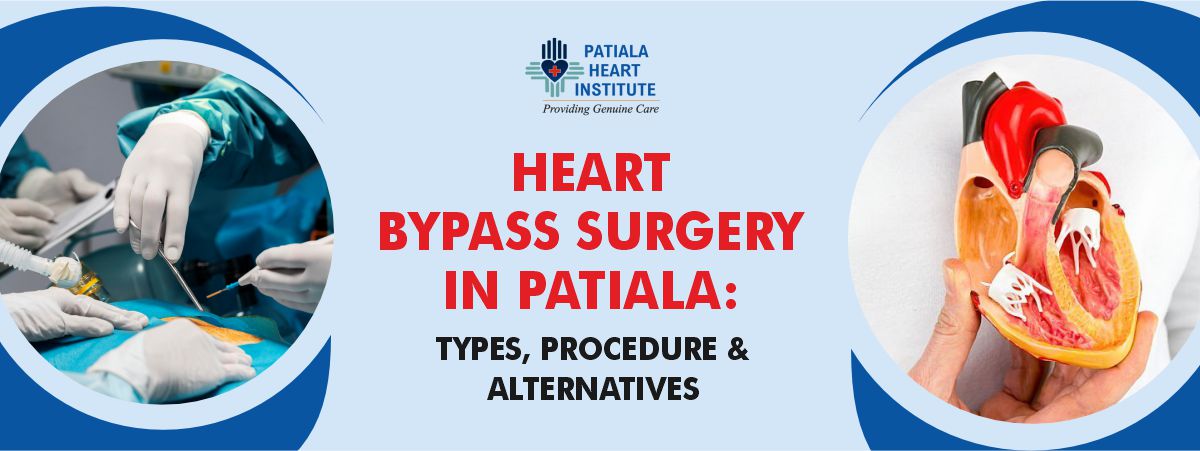 Types and Procedures of Heart Bypass Surgery – Patiala Heart