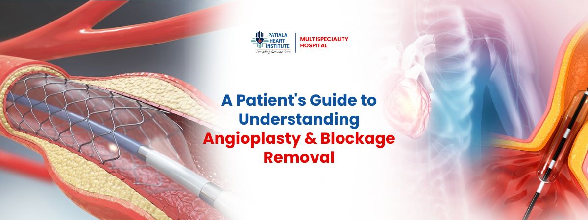 Guide to Understanding Angioplasty and Blockage Removal