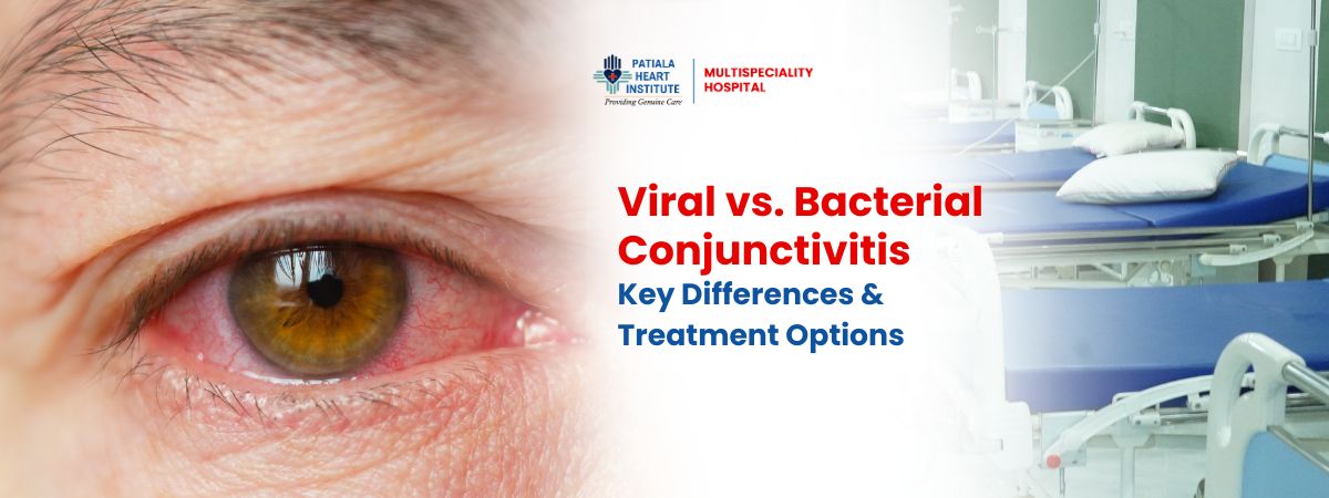 Viral Conjunctivitis Vs Bacterial Conjunctivitis